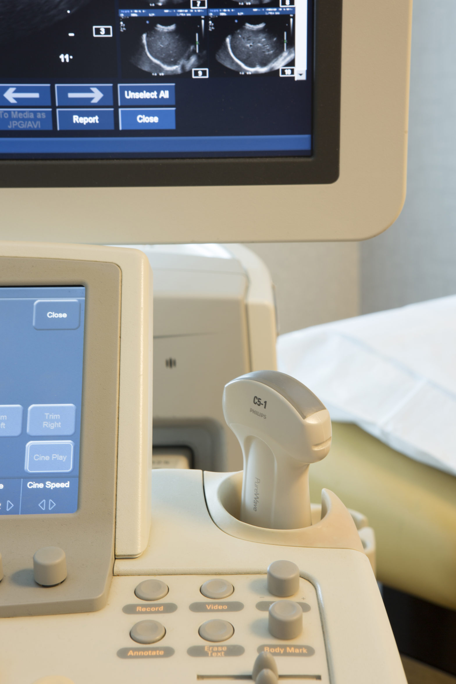 Breast Imaging - University Diagnostic Medical Imaging
