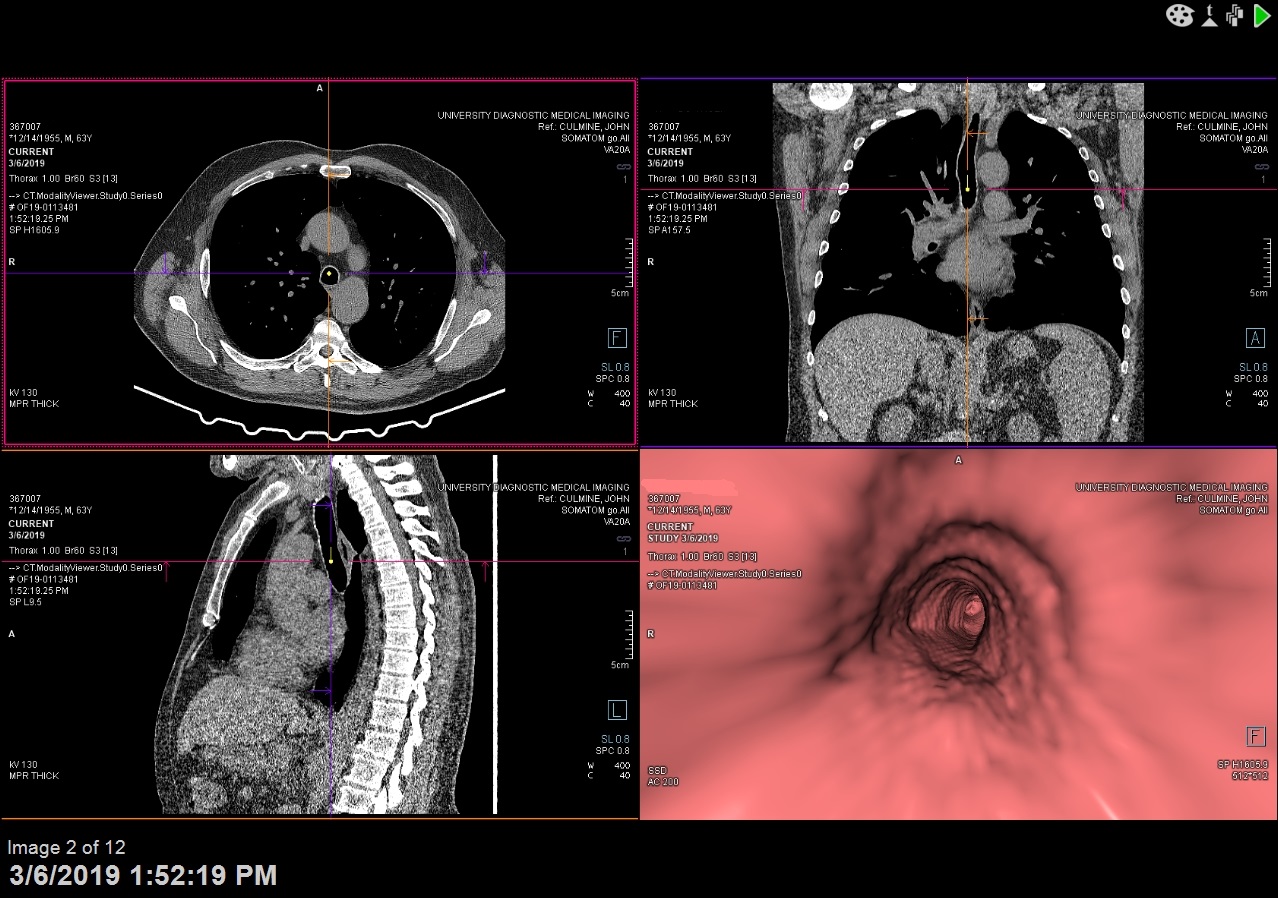 64-Slice Computed Tomography (CT) - University Diagnostic Medical Imaging 64-Slice Computed Tomography (CT) - University Diagnostic Medical Imaging